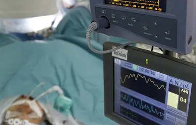 This is what it’s like waking up during surgery