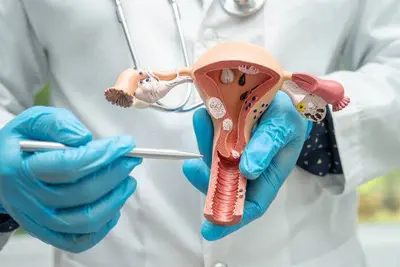 Why so many government patients get cervical cancer — and what to do ...